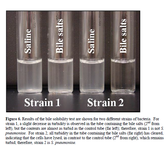 Identification and Characterization of Streptococcus pneumonia : Bile ...