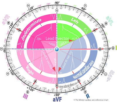 ECG Educator Blog : Cardiac Axis Made Easy