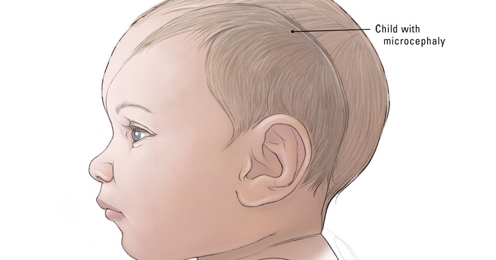 InterPro database blog: Zika Virus and Microcephaly