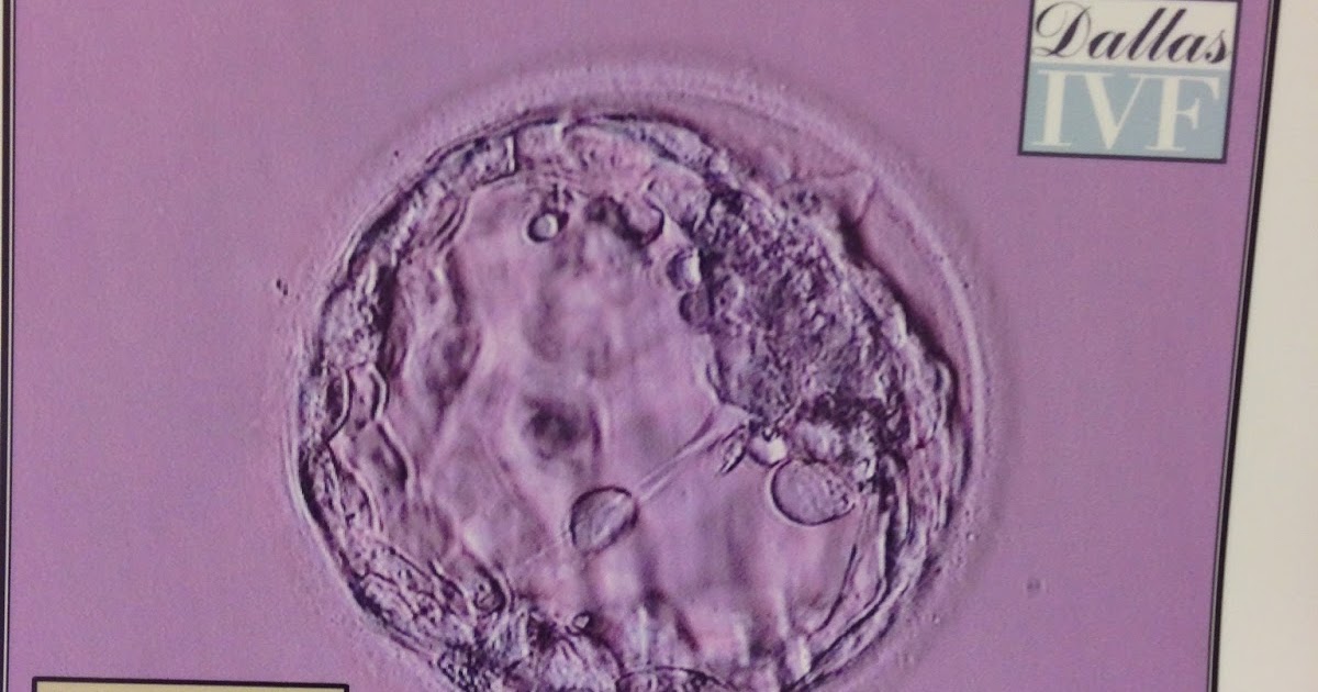 IVF #2 Update - The Mrs. & Co.