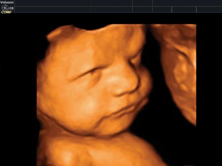 ...Momento Mágico...: NOVIDADES- Dor de Dente e Ecografia 4D