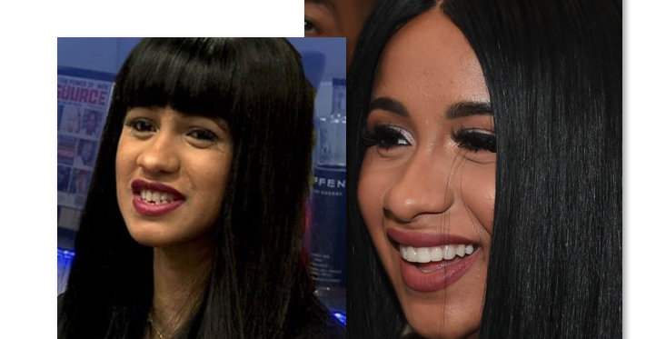 Cardi B Teeth Before And After Old Smile Vs New