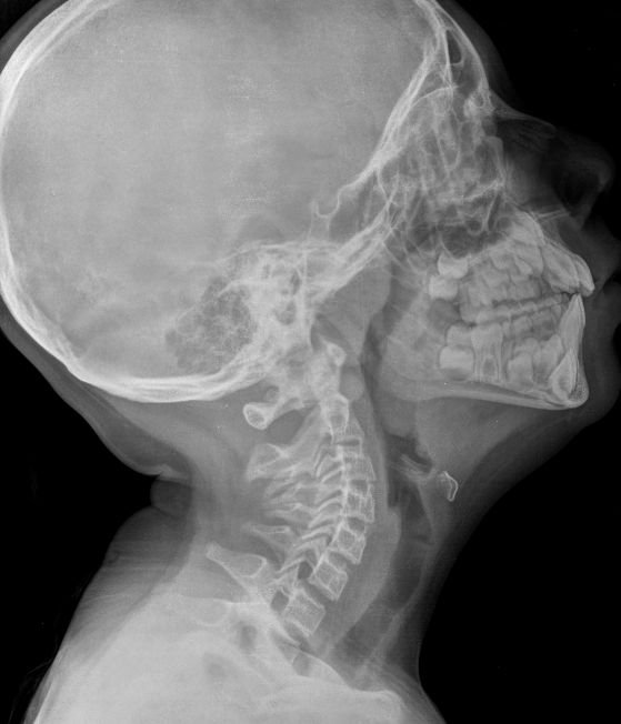 MedicoNotebook: 2016