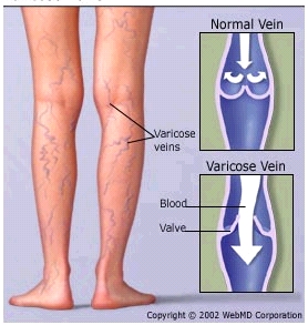 Petua Orang Tua: Urat Hijau di Kaki/Betis