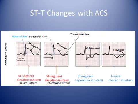 Elevation And Depression Anatomy