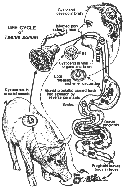 Under the Microscope: Taenia solium and the leaky brain cyst