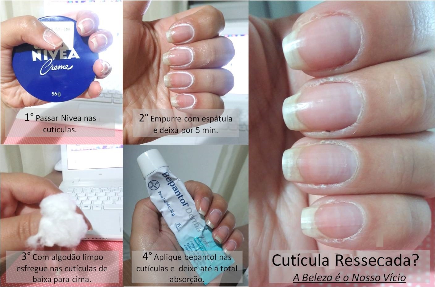 A Beleza é o Nosso Vício: Cutículas Ressecadas???