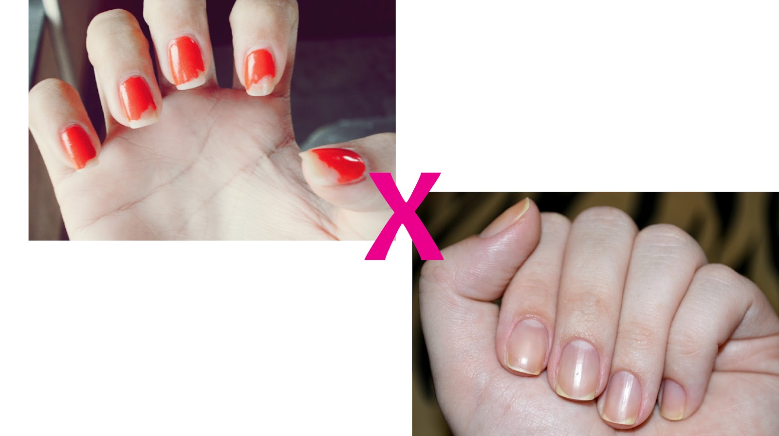 tchostyle: Unhas descascadas x Unhas limpinhas