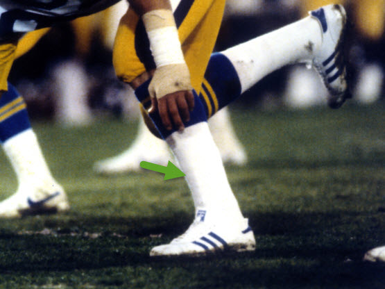 Pro Football Journal: Players with Broken Legs Are 0-4 in Super Bowls