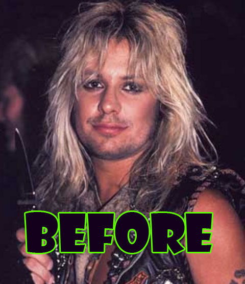 Vince Neil Plastic Surgery Before and After Brow lift, Check Lift and ...