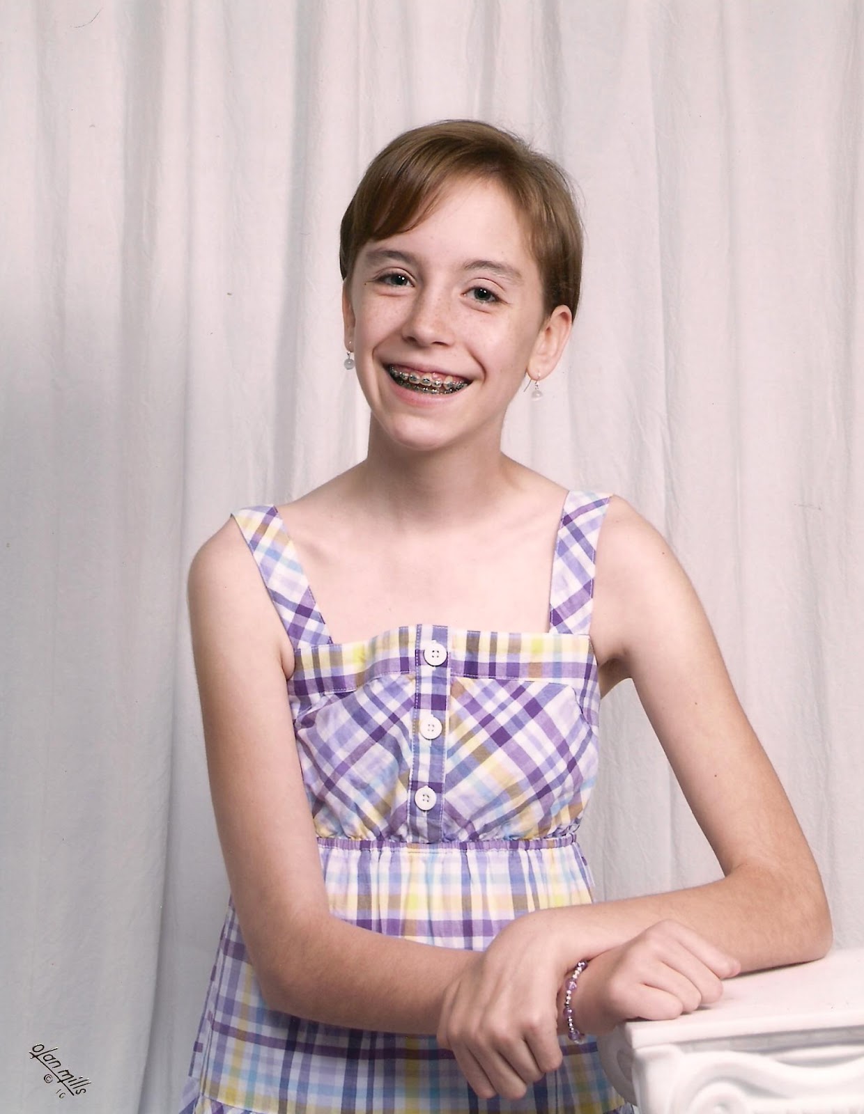 2q37 (Cromosome 2) Deletion Syndrome: Victoria Anne 1996 - Present 16 ...