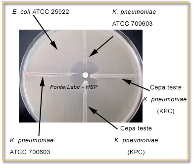KPC - Teste de Hodge Modificado - Tira o Jaleco