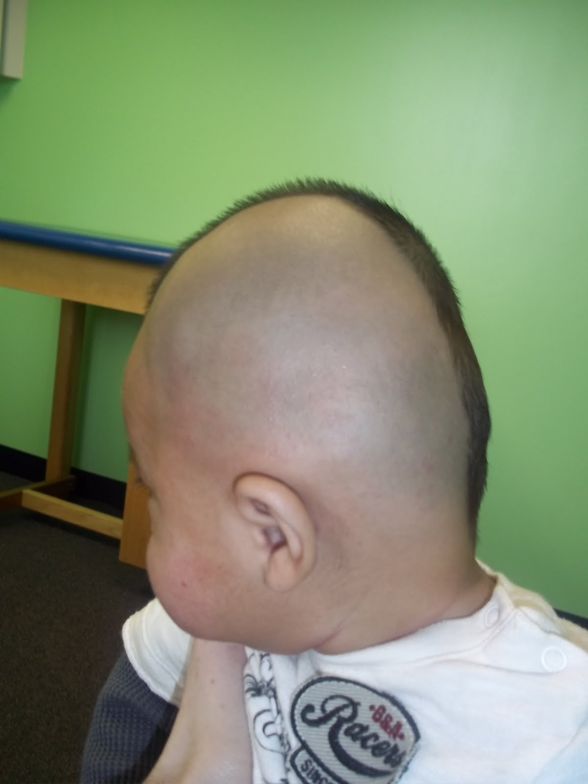 A Beautiful Life: Before and After