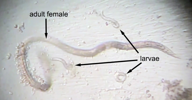 Creepy Dreadful Wonderful Parasites: Answer to Case 499