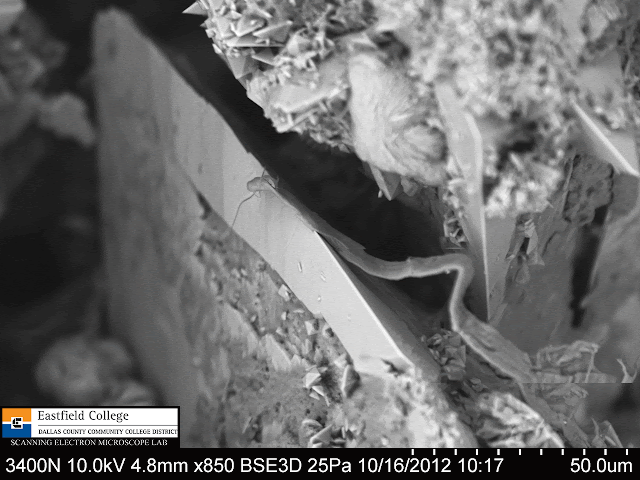 Scanning Electron Microscope Blog: A Kidney Stone - OUCH!!