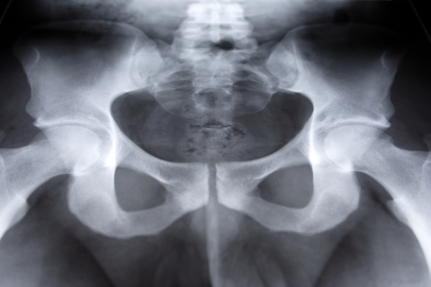 elFutbloglin: La pubalgia del futbolista