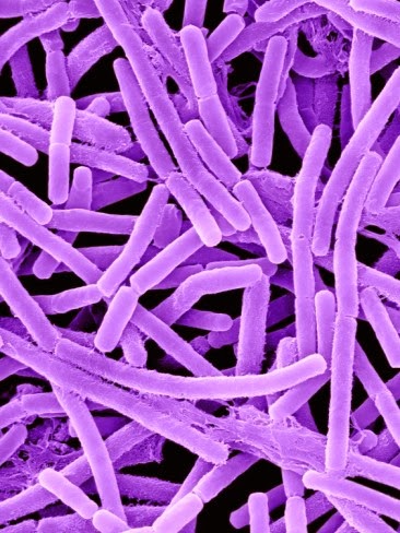 CIRI, STRUKTUR DAN BENTUK BAKTERI ~ blog'e enyong