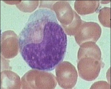 Fichero de Hematología: Metamielocito (Neutrófilo)