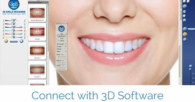 Dental GPS smile design software (DSD)