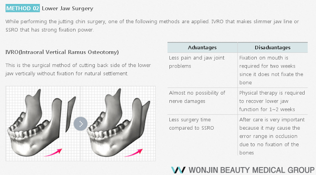 Korea Two Jaw Surgery Wonjin Beauty Medical Group - Jutting Jaw ...