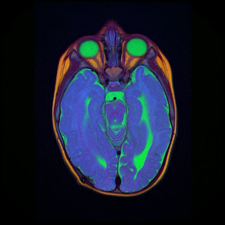 Nevit's blog: Color MRI of the BRAIN