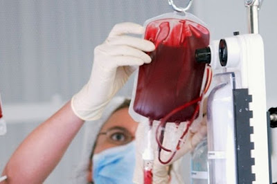 Berapa Jumlah Darah Yang Diperlukan Untuk Transfusi Thalassemia ...