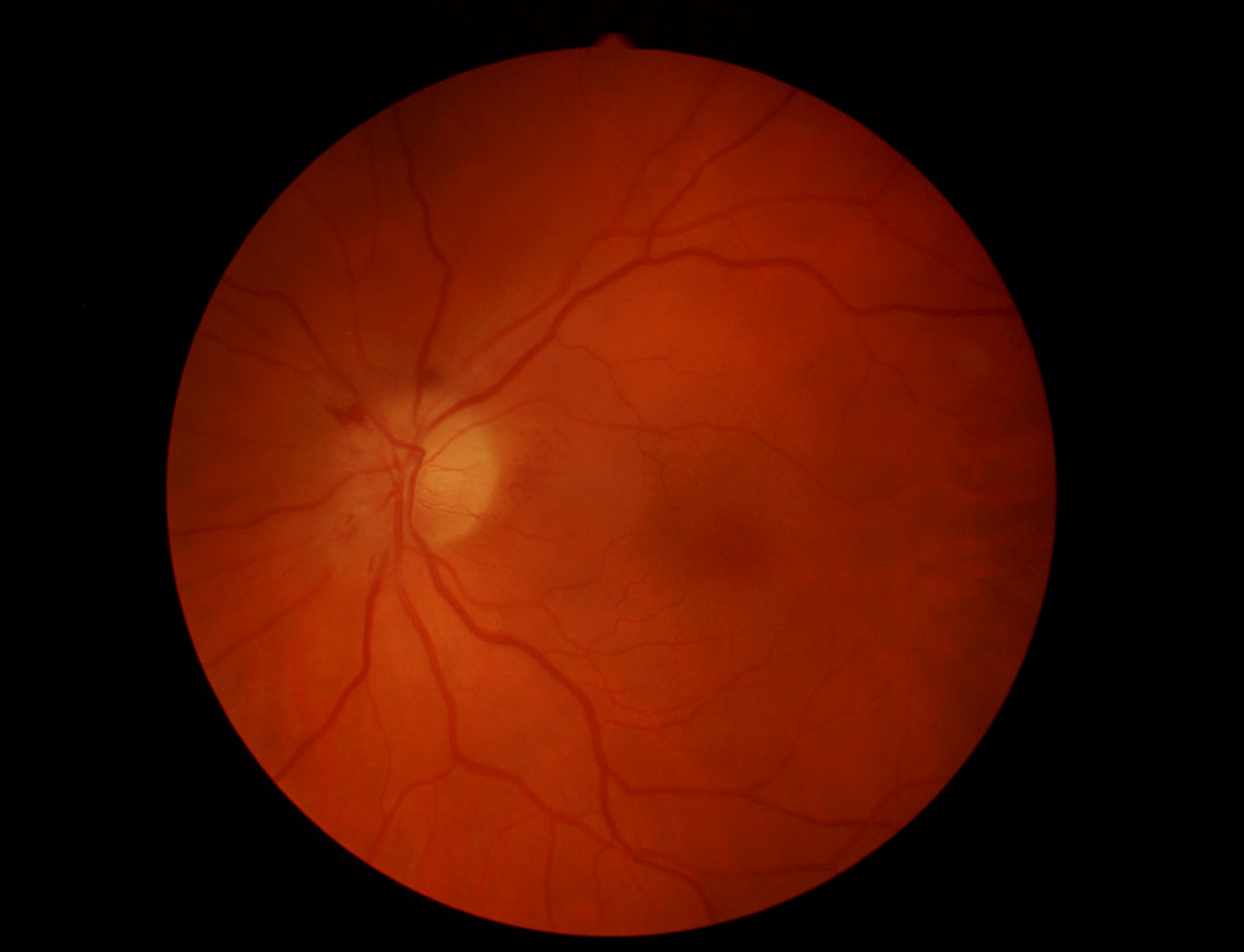 RichmondOptometry.com: The Eye is the Window to Your Body's Health