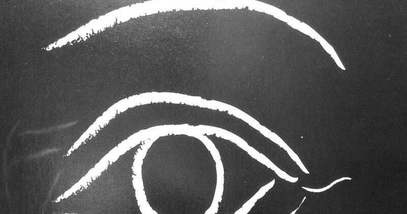 Mata Juling : Penyebab Juling Dan Cara Mengobati Mata Juling Pada Anak ...