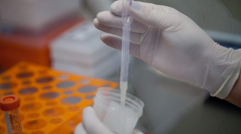 SyM Clínica Ocupacional y Asistencial S.A.C: ¿Qué es un espermograma y ...