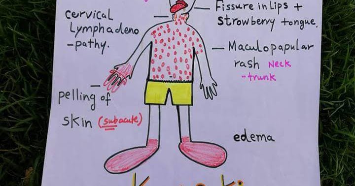 CARTOONS FOR SOME SYNDROMES