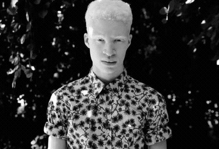 Ceci n'est pas de la mode: Shaun Ross, first albino male model.