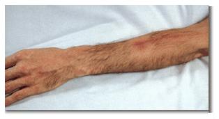 Enfermagem, aprendendo, realizando e ensinando o cuidado: Terapia ...