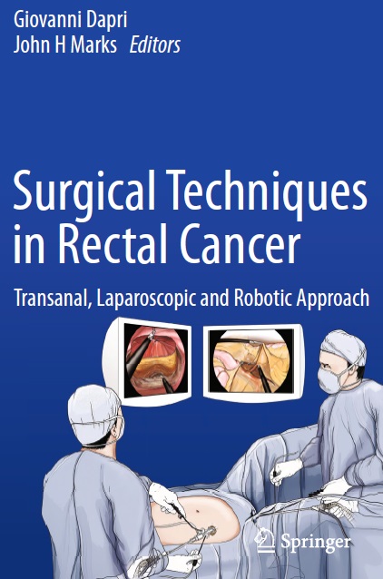 Surgical Techniques in Rectal Cancer - Medical Yukti