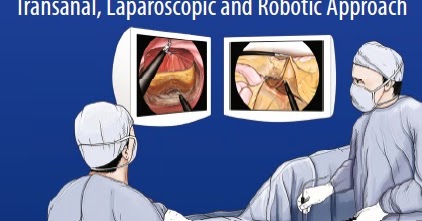 Surgical Techniques in Rectal Cancer - Medical Yukti