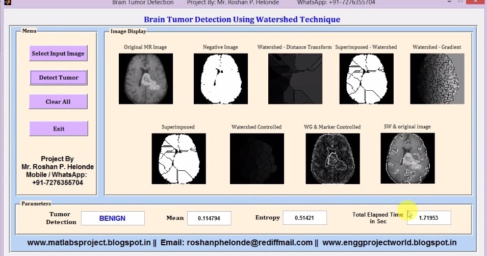 Brain Tumor Detection and Classification using Watershed Technique ...