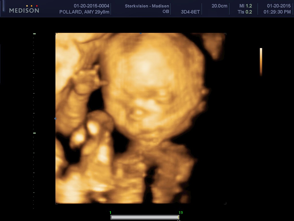Pollard Family: Baby Pictures