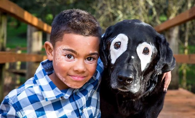 White Wolf : Boy with a rare skin disorder hates his looks, until he ...