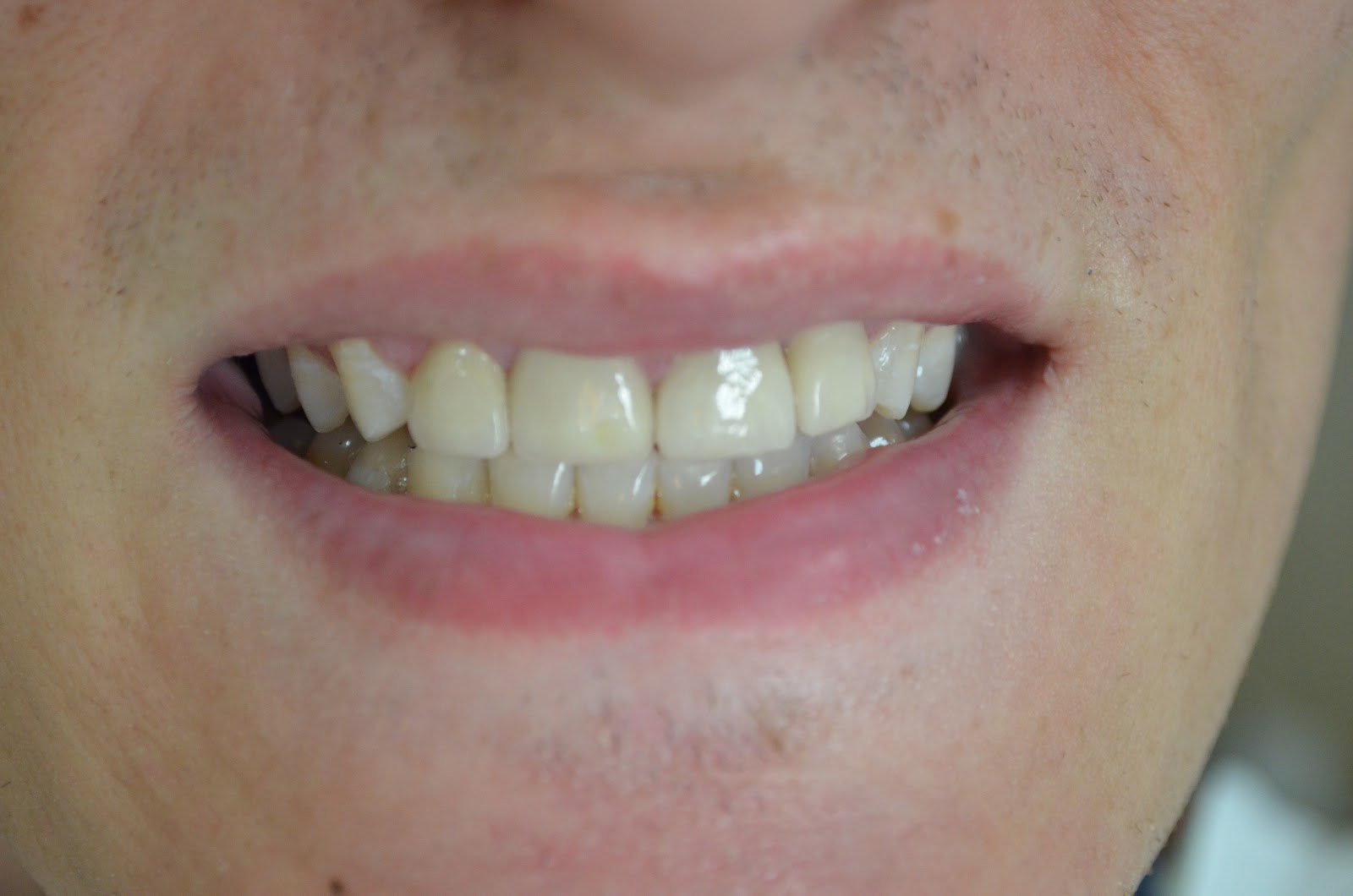 South Shore Smiles - Dr. Alice Cheng, DDS