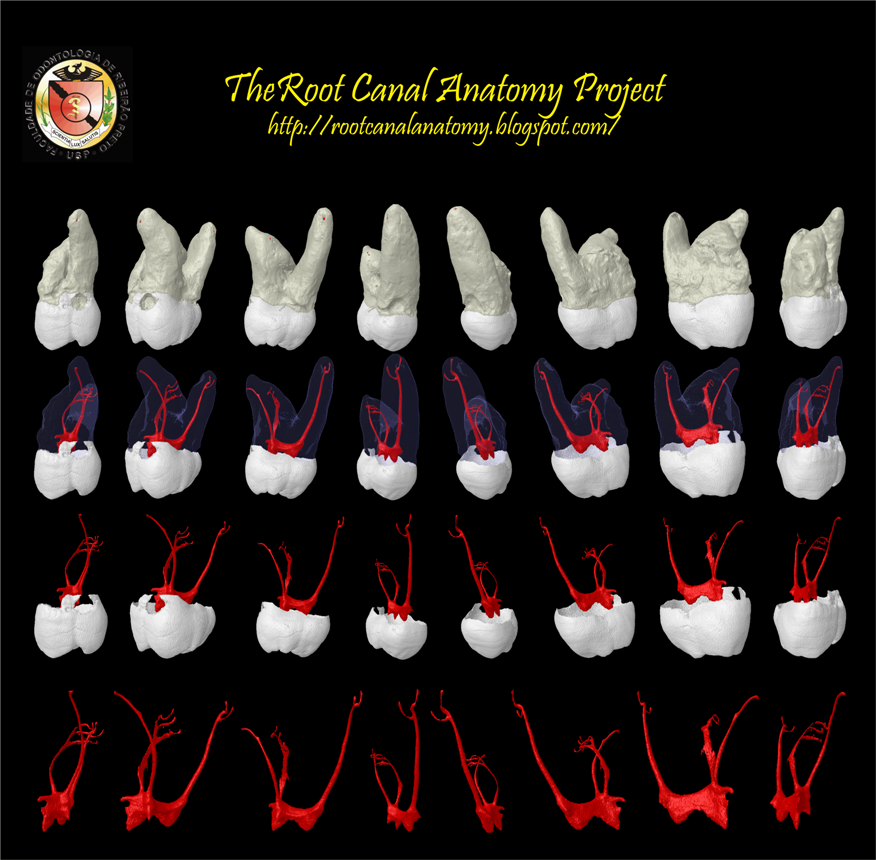 Root Canal Maxillary First Molar Anatomy