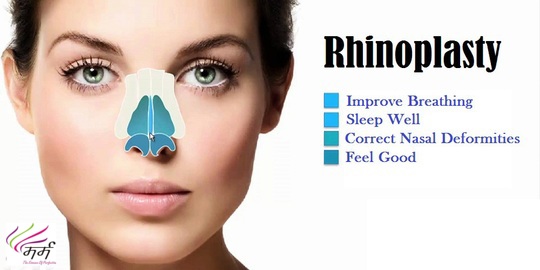 How To Deal With Bulbous Nasal Tip?