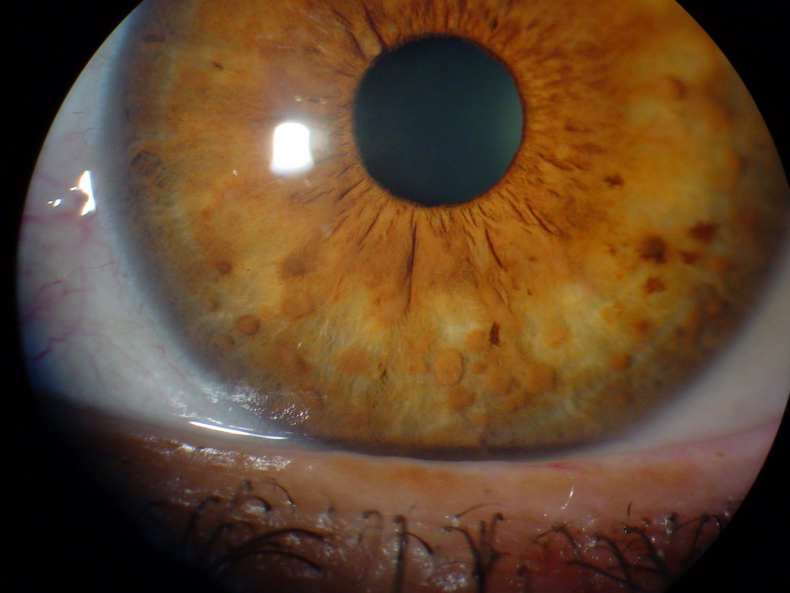 EL RINCÓN DE LA MEDICINA INTERNA. juanpedromacaluso@yahoo.com.ar ...