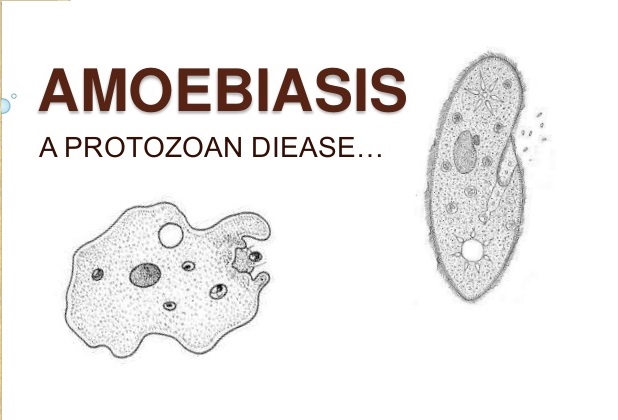 Laxmi Homeo Clinic: Amoebiasis treatment and remedies