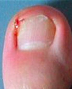 Whittal Tree: The tender love of my mother