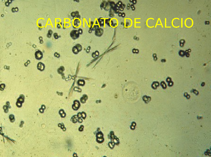 Carbonato De Calcio Vs Citrato De Calcio