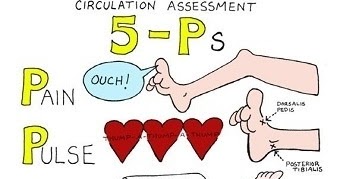Notez On Nursing....: The 5 P's.....