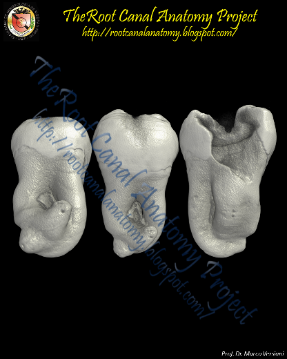 The Root Canal Anatomy Project: Root Curvature