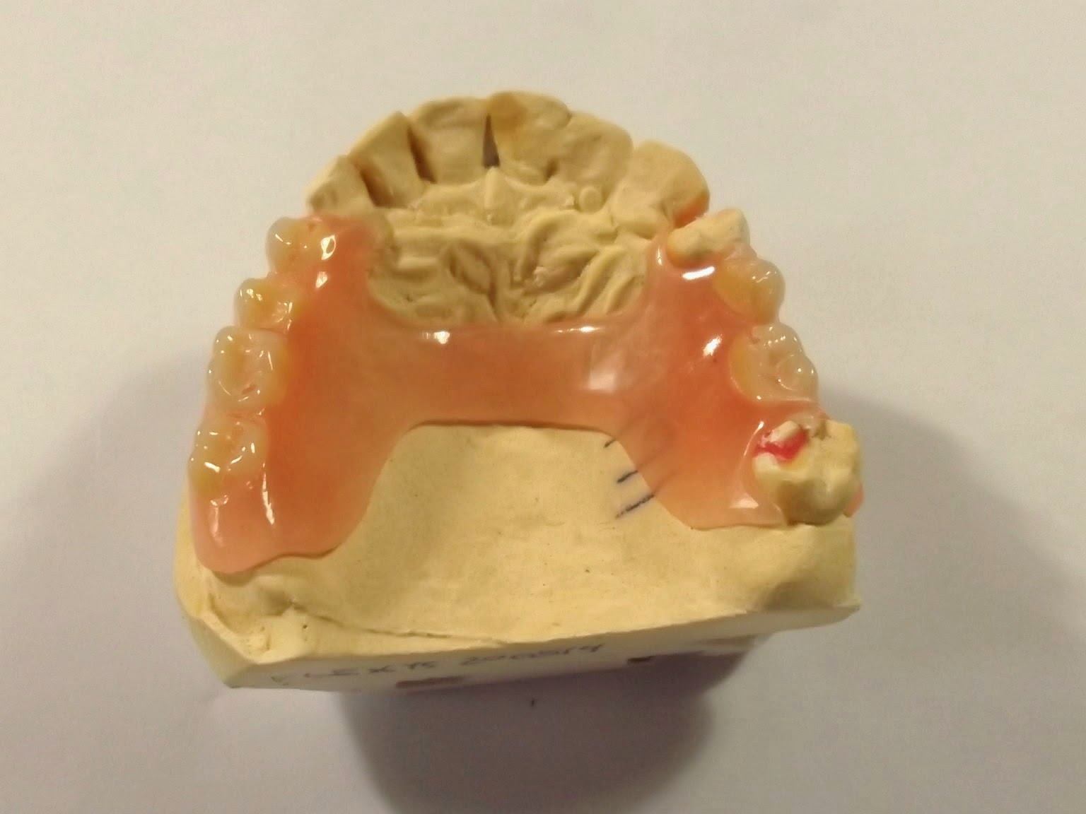 Laboratorio Flexys: Próteses Flexíveis Unilaterais