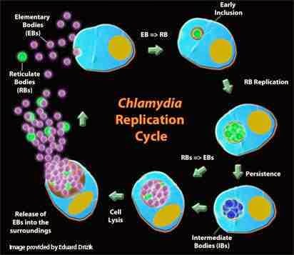chlamydia diagnosis ~ infectious diseases