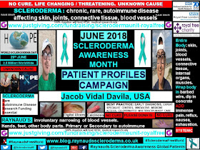 Raynauds Scleroderma Global Patients: Jacob Vidal Davila, USA. June ...
