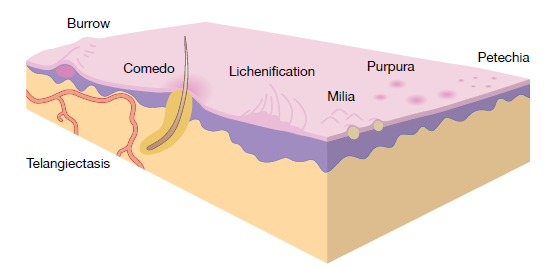 Examining The Skin and Describing Lesions | Dermatology Information ...